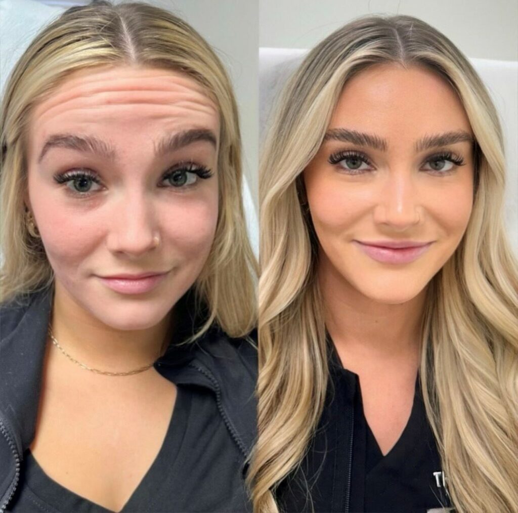 Results - The Face Bar Aesthetic Medical DBA